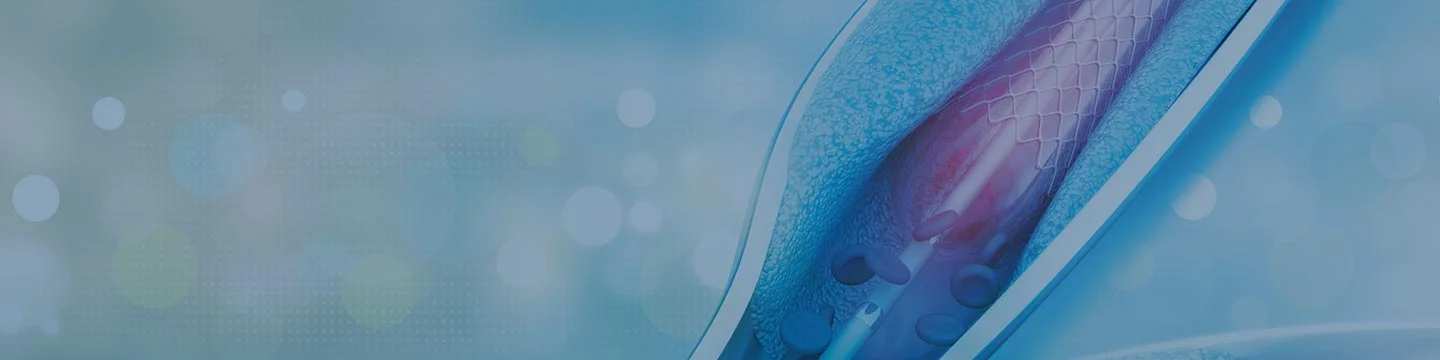 Inferior Vena Cava (IVC) Filter Placement and Removal